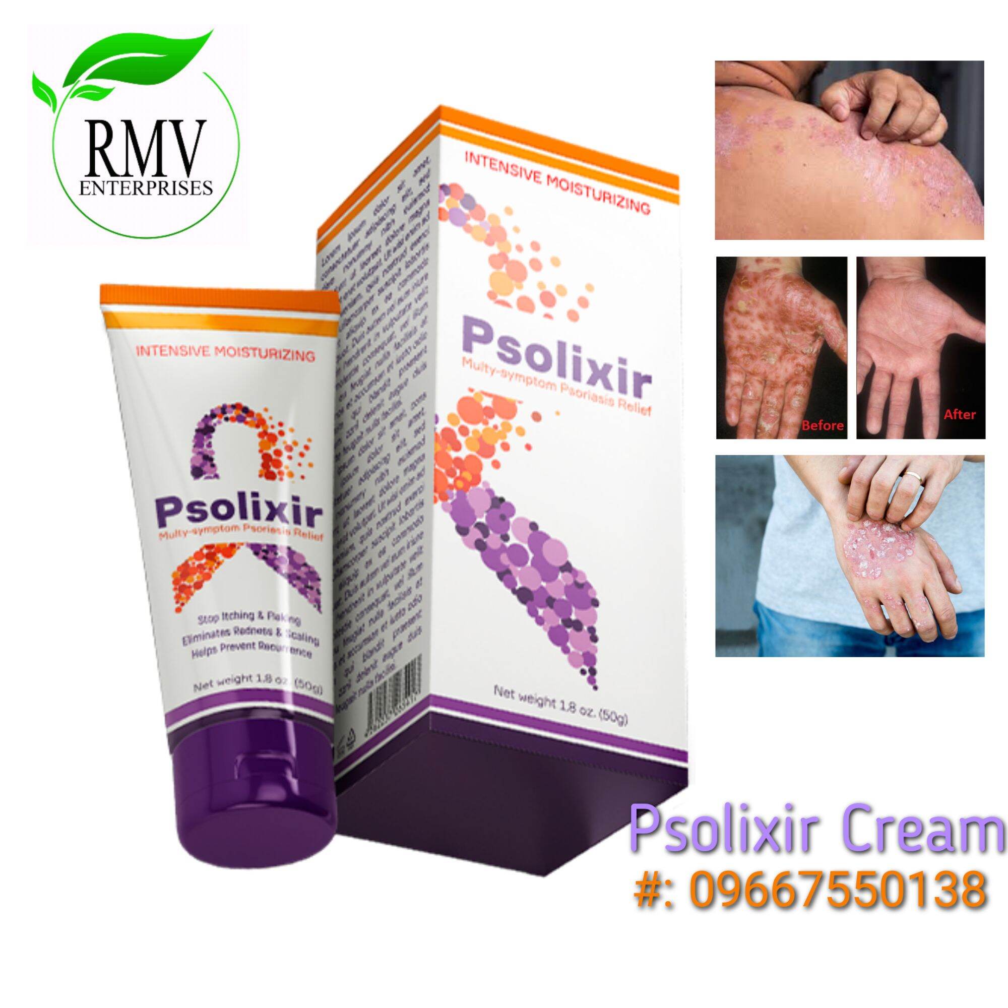 Psolixir Anti-Psoriasis Cream eczema Intensive Moisturized | Lazada PH