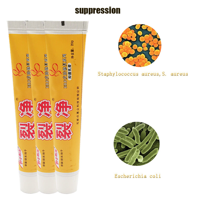 Moisture hand cream Treat Cracked hands Itchy hands Peeling ...