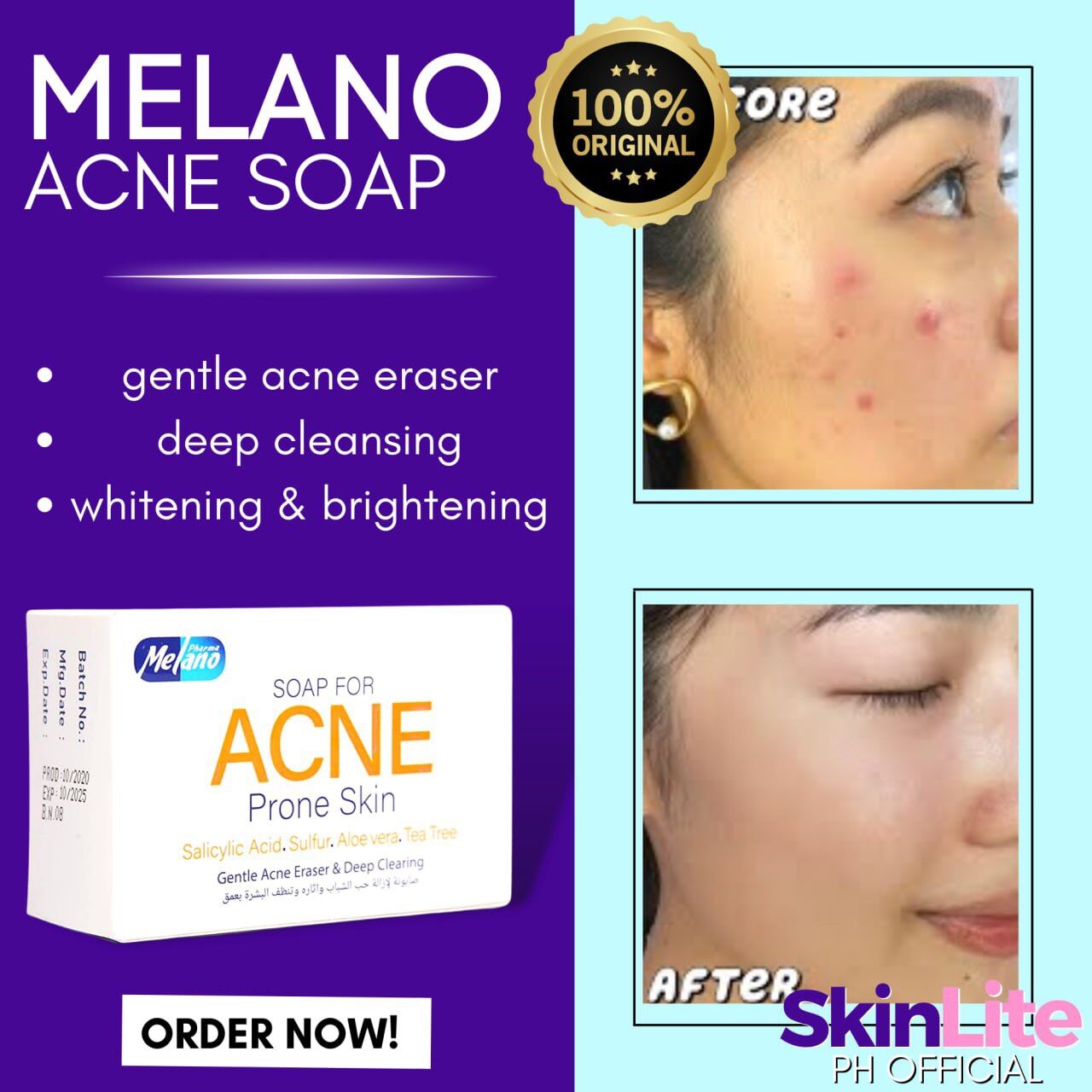 Melanofree 20g melasma remover whitening pigmentation cream | Lazada PH