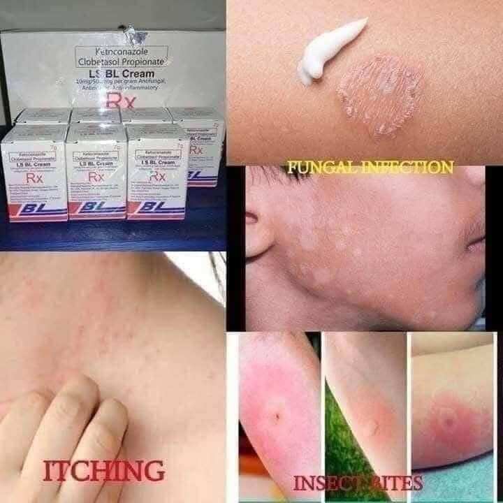 Bl cream original | Lazada PH