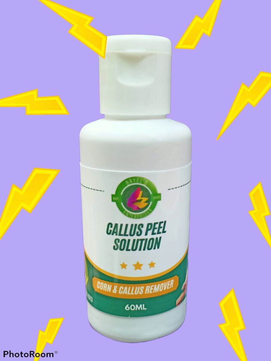 KALYO PEEL/CALLUS AND CORN PEELING SOLUTION/KALYO REMOVER 60ml CALLUS PEEL REMIOVER SOLUTION ...