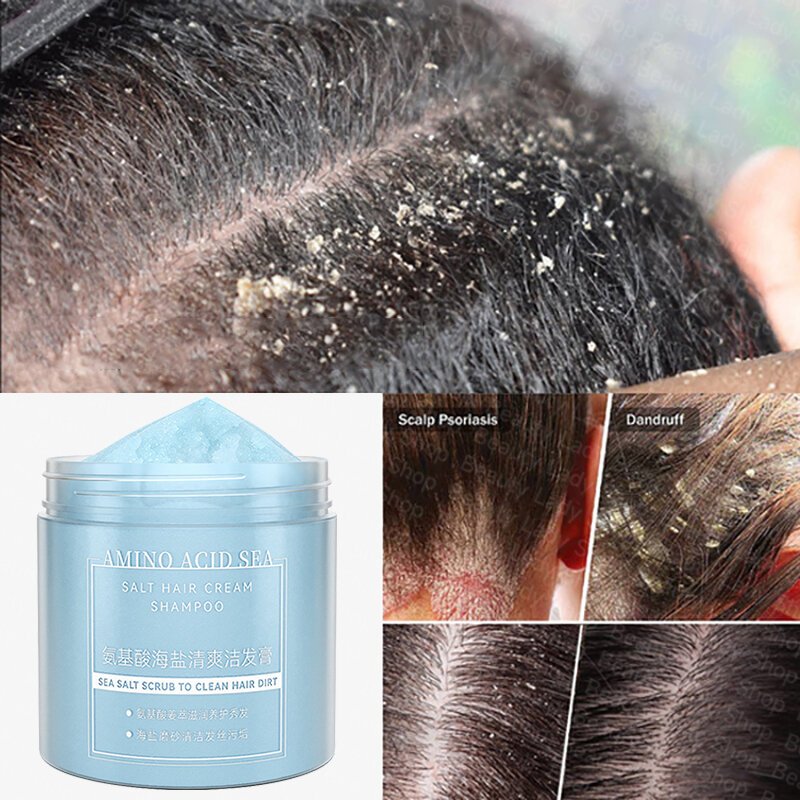 Sea Salt Shampoo Anti Dandruff Hair Treatment Shampoo For Scalp Itching ...
