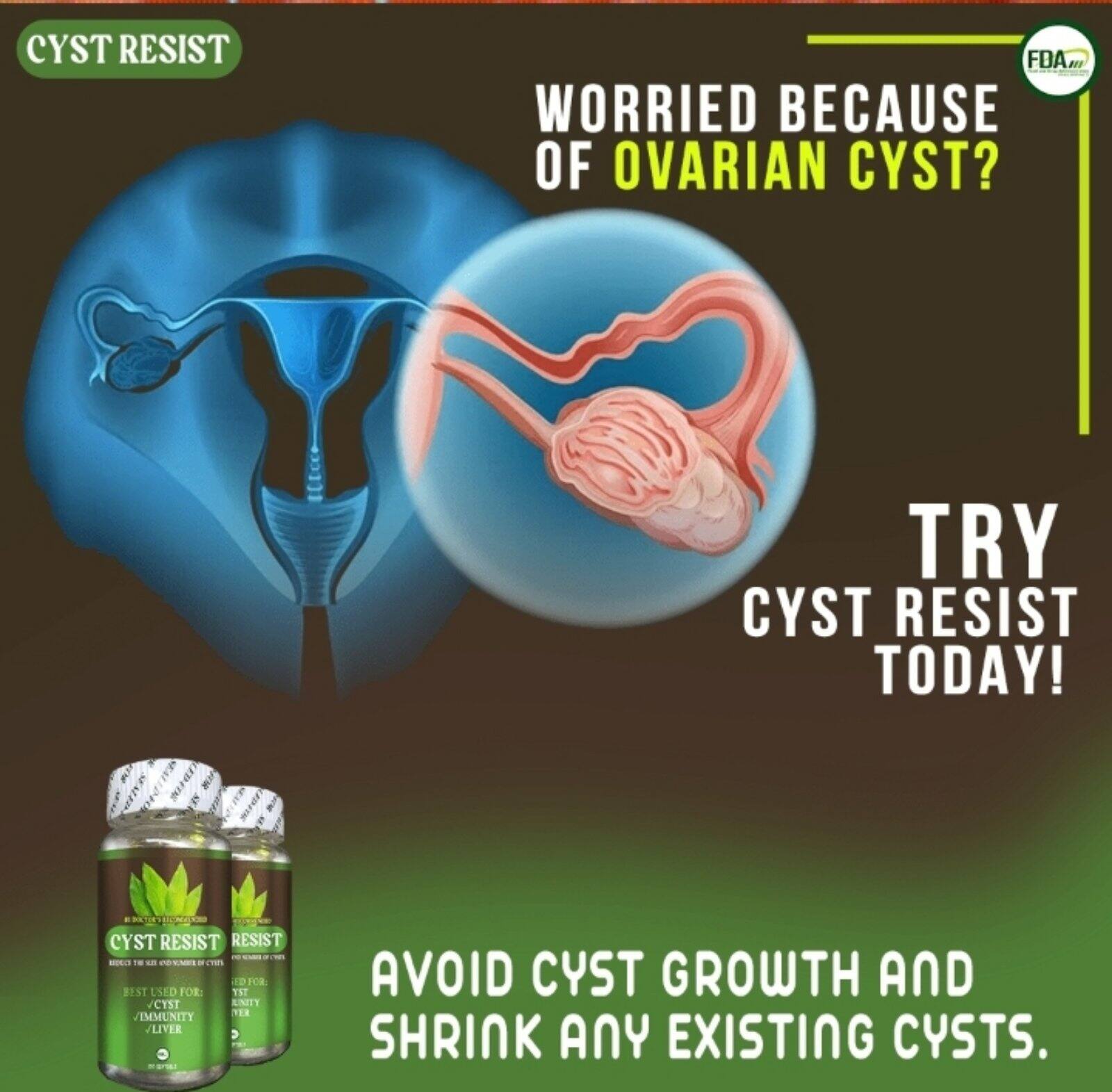 CYST RESIST SOFTGels | Lazada PH