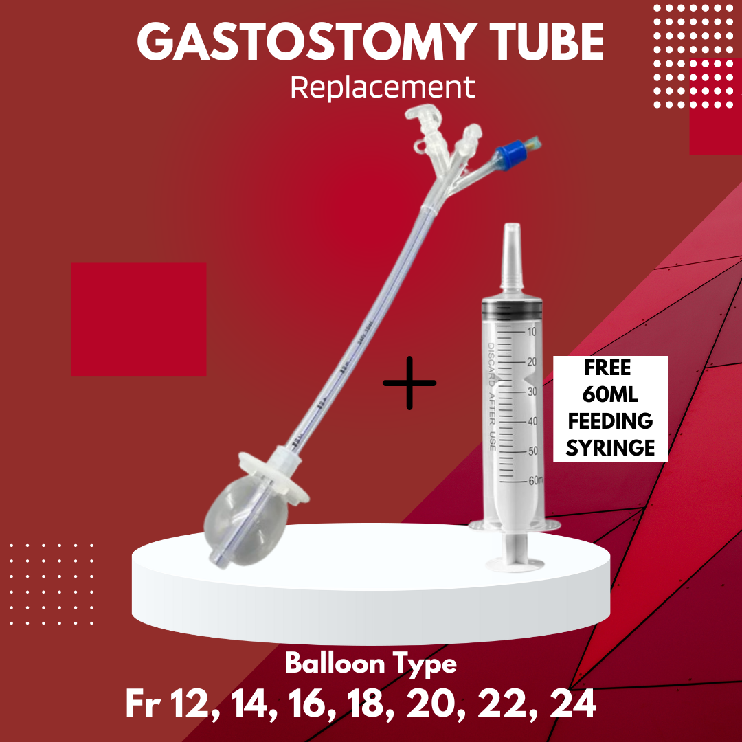 Gastrostomy Feeding Tube PEG Replacement Tube | Lazada PH