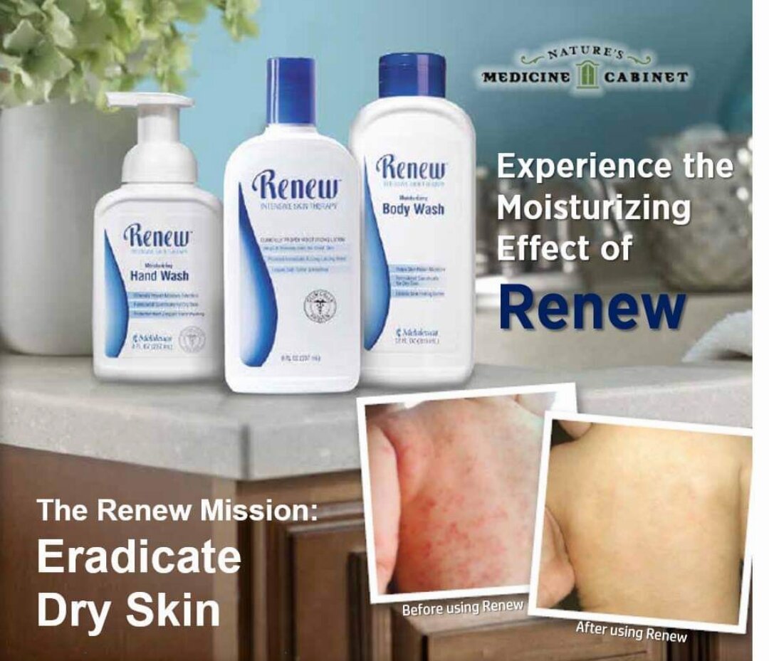 Renew Intensive Skin Therapy Lotion, 237ml Tube Size | Lazada PH