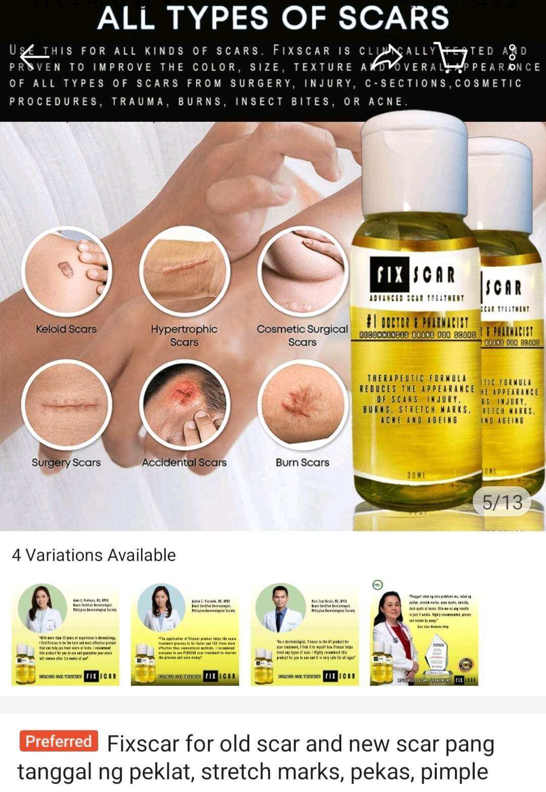 Fixscar for old scar and new scar pangtanggal ng peklat,stretch marks ...