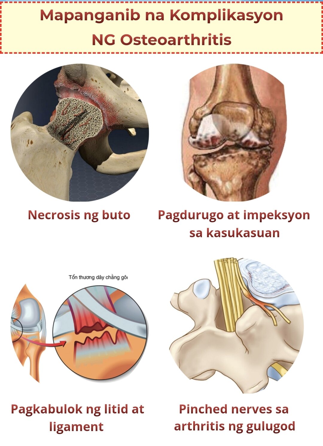 ENSURE MAX COLOSTRUM MILK 400g- Strong Bones, Healthy Joints, Golden ...