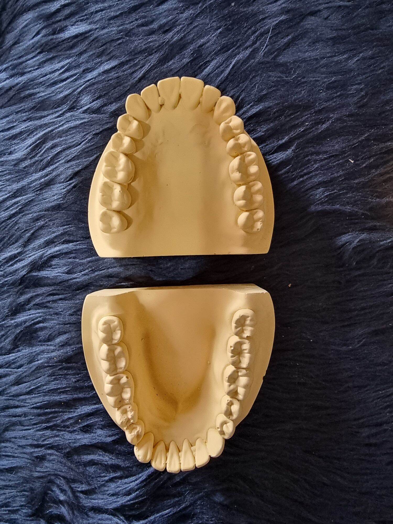 Dentolous and Edentulous Cast Model | Lazada PH