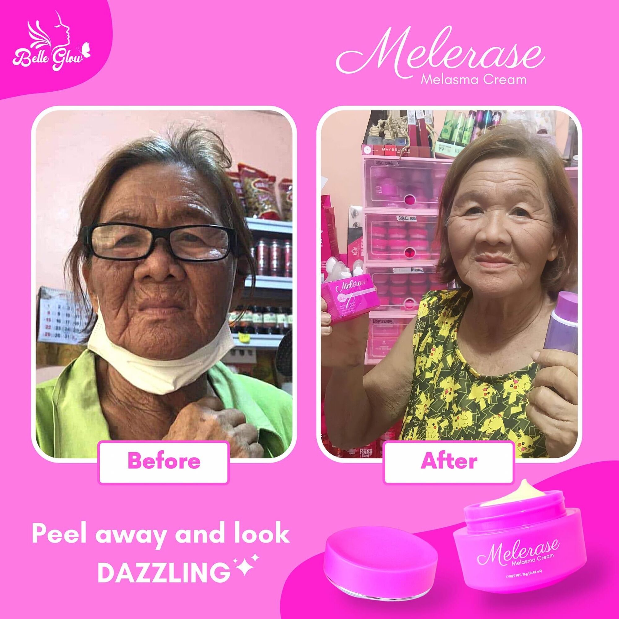 MELERASE MELASMA CREAM BY BELLEGLOW | Lazada PH