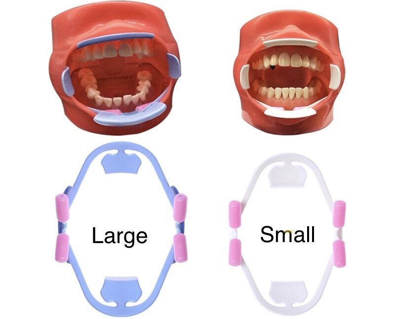 SMALL 3D cheek retractor | Lazada PH